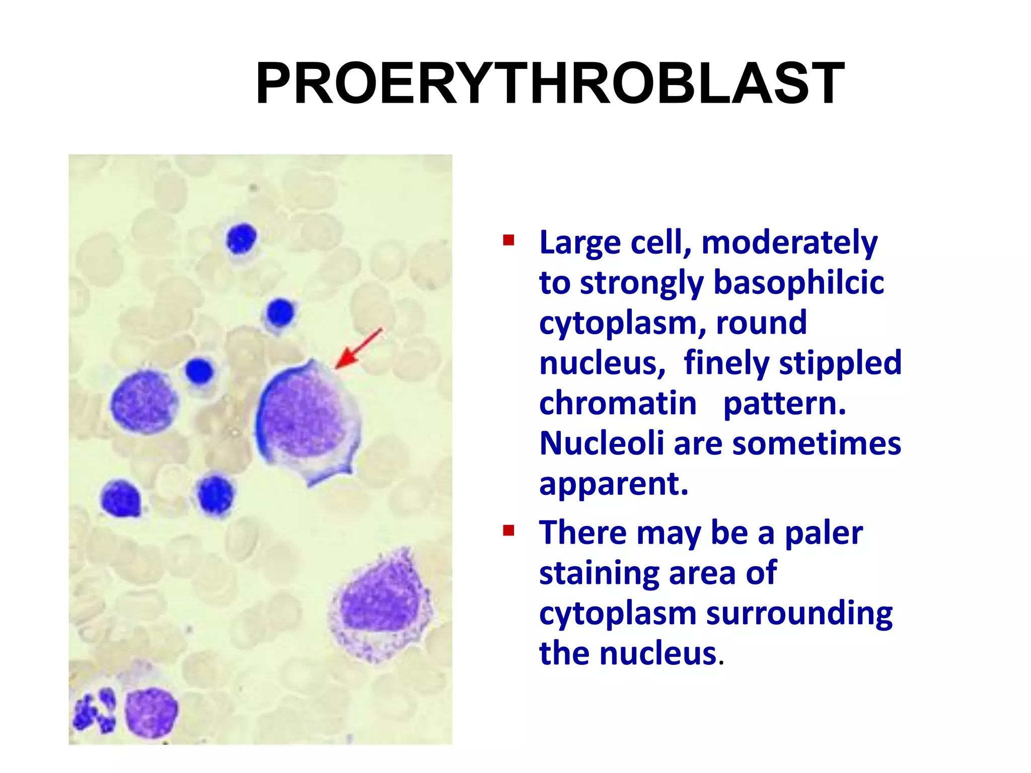 Morphology of bone marrow aspirates - Dr Hurwitz.pdf
