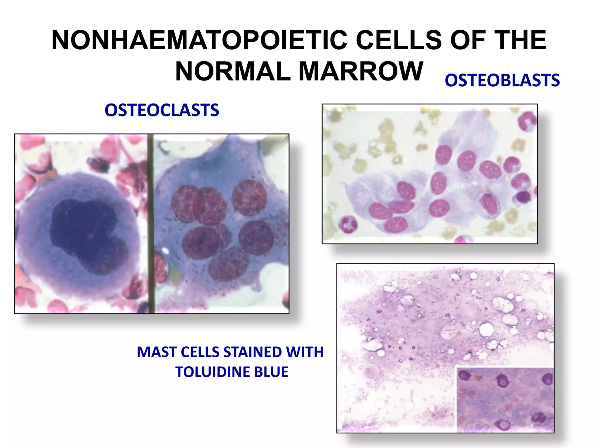 Morphology of bone marrow aspirates - Dr Hurwitz.pdf