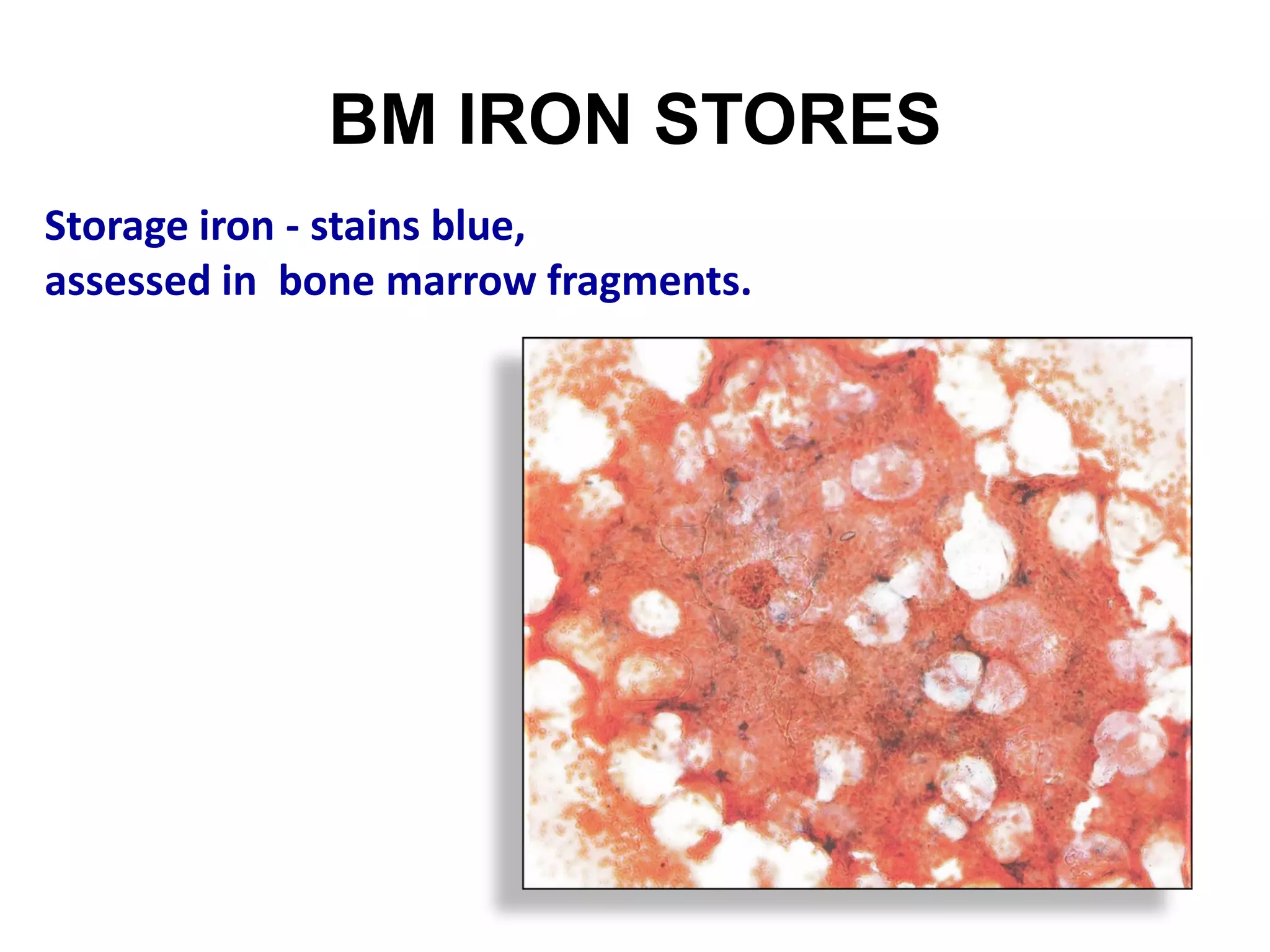 Morphology of bone marrow aspirates - Dr Hurwitz.pdf