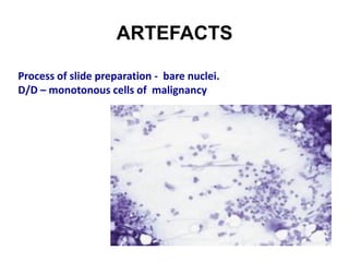 Morphology of bone marrow aspirates - Dr Hurwitz.pdf