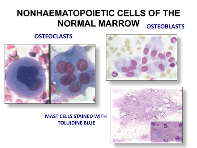 Morphology of bone marrow aspirates - Dr Hurwitz.pdf