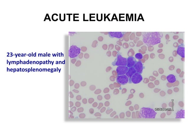 Morphology of bone marrow aspirates - Dr Hurwitz.pdf