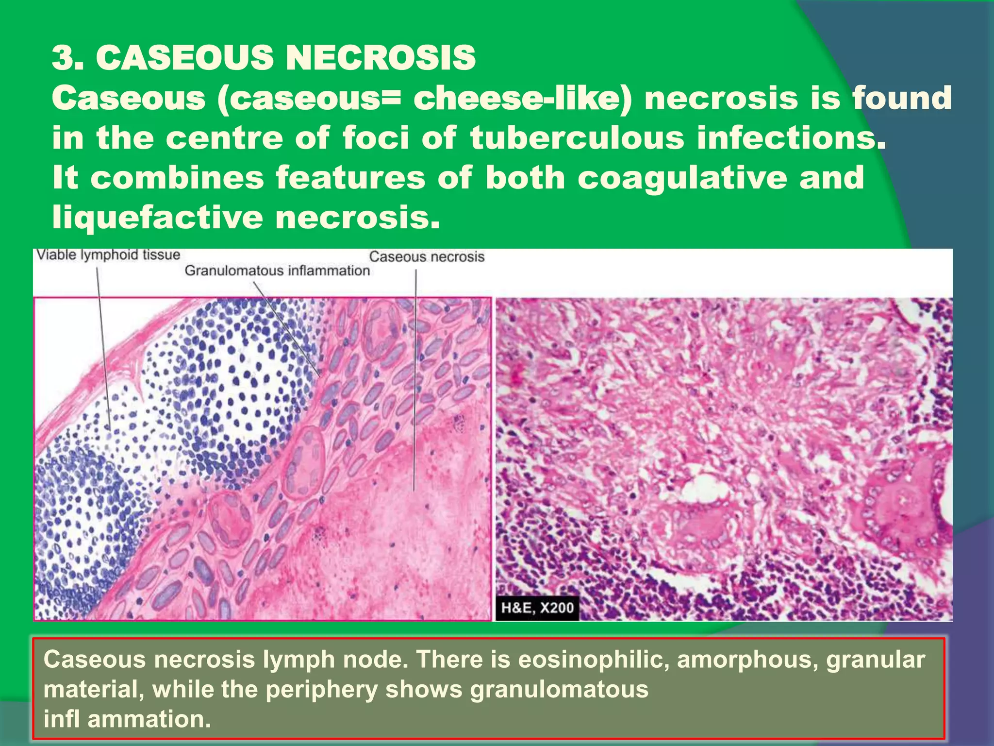 Morphology of cell injury and Intracellular accumulationspptx | PPTX