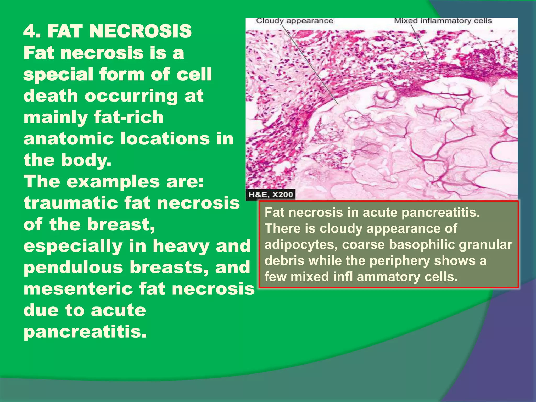 Morphology of cell injury and Intracellular accumulationspptx | PPTX