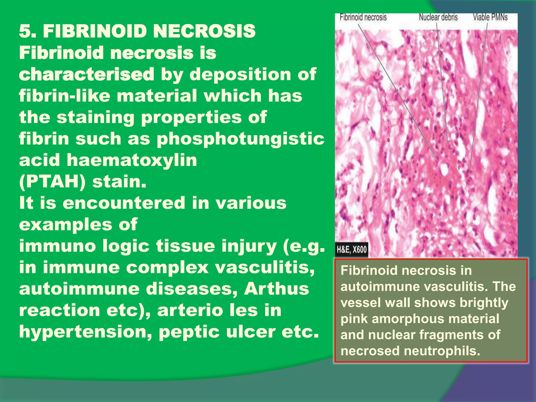 Morphology of cell injury and Intracellular accumulationspptx | PPTX