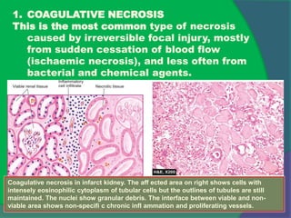 Morphology of cell injury and Intracellular accumulationspptx | PPTX
