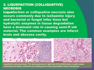 Morphology of cell injury and Intracellular accumulationspptx | PPTX