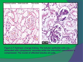 Morphology of cell injury and Intracellular accumulationspptx | PPTX