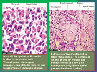 Morphology of cell injury and Intracellular accumulationspptx | PPTX