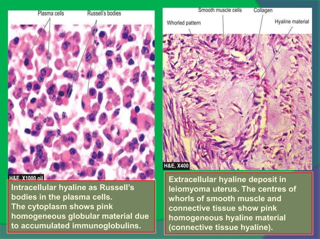 Morphology of cell injury and Intracellular accumulationspptx | PPTX ...