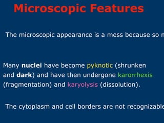Coagulative Necrosis + Morphology | PPTX