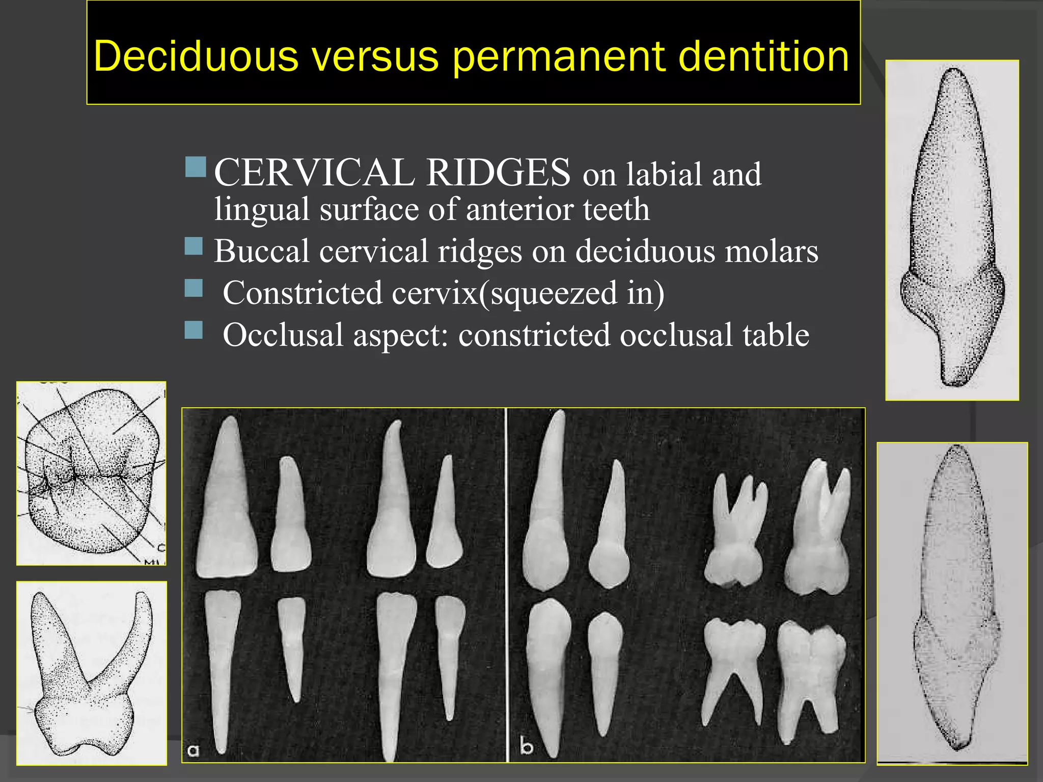 Morphology of deciduous dentition | PPT