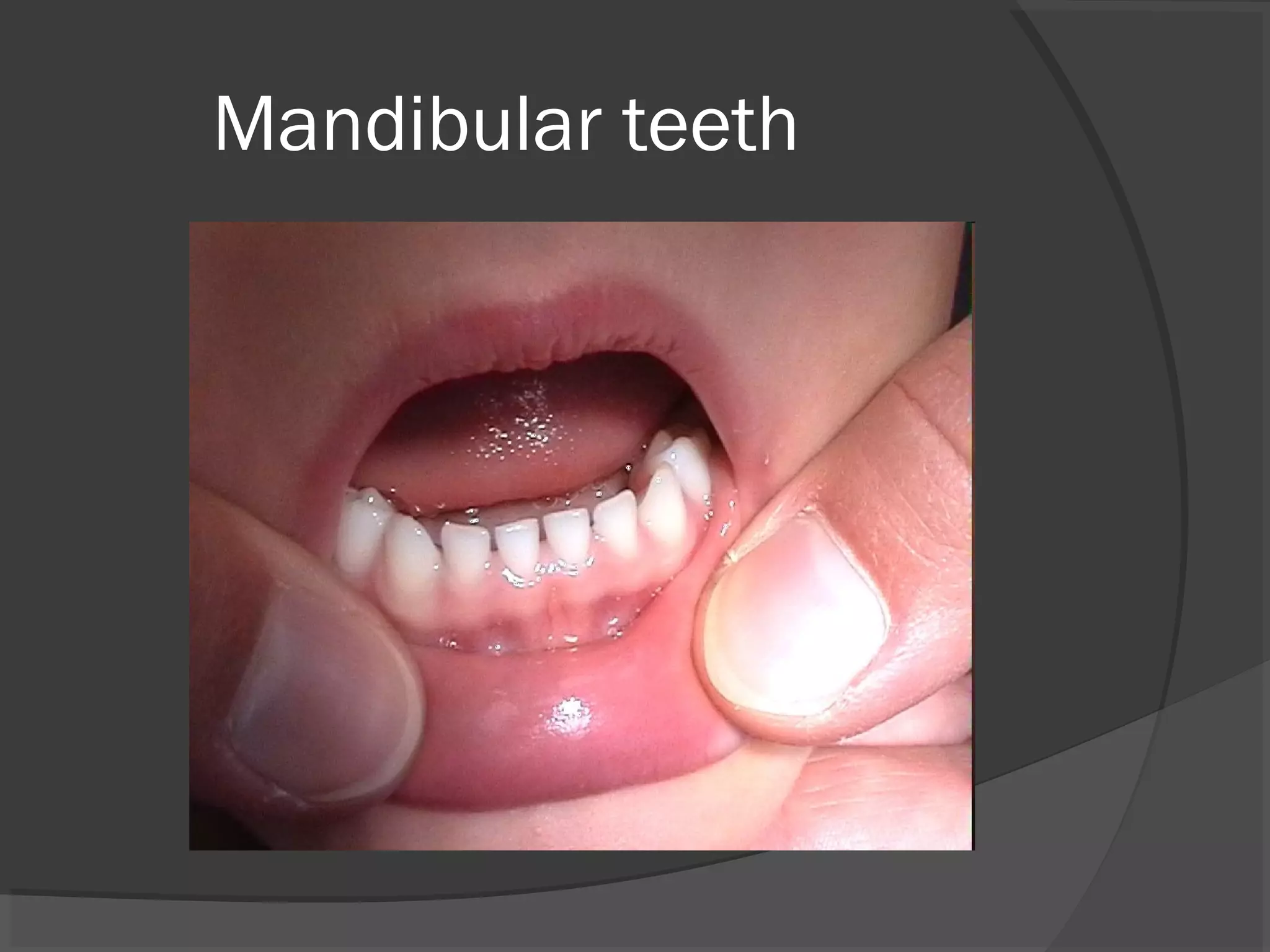Morphology of deciduous dentition | PPT | Oral care | Personal Care