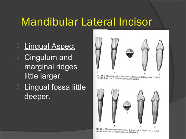 Morphology of deciduous dentition | PPT | Oral care | Personal Care