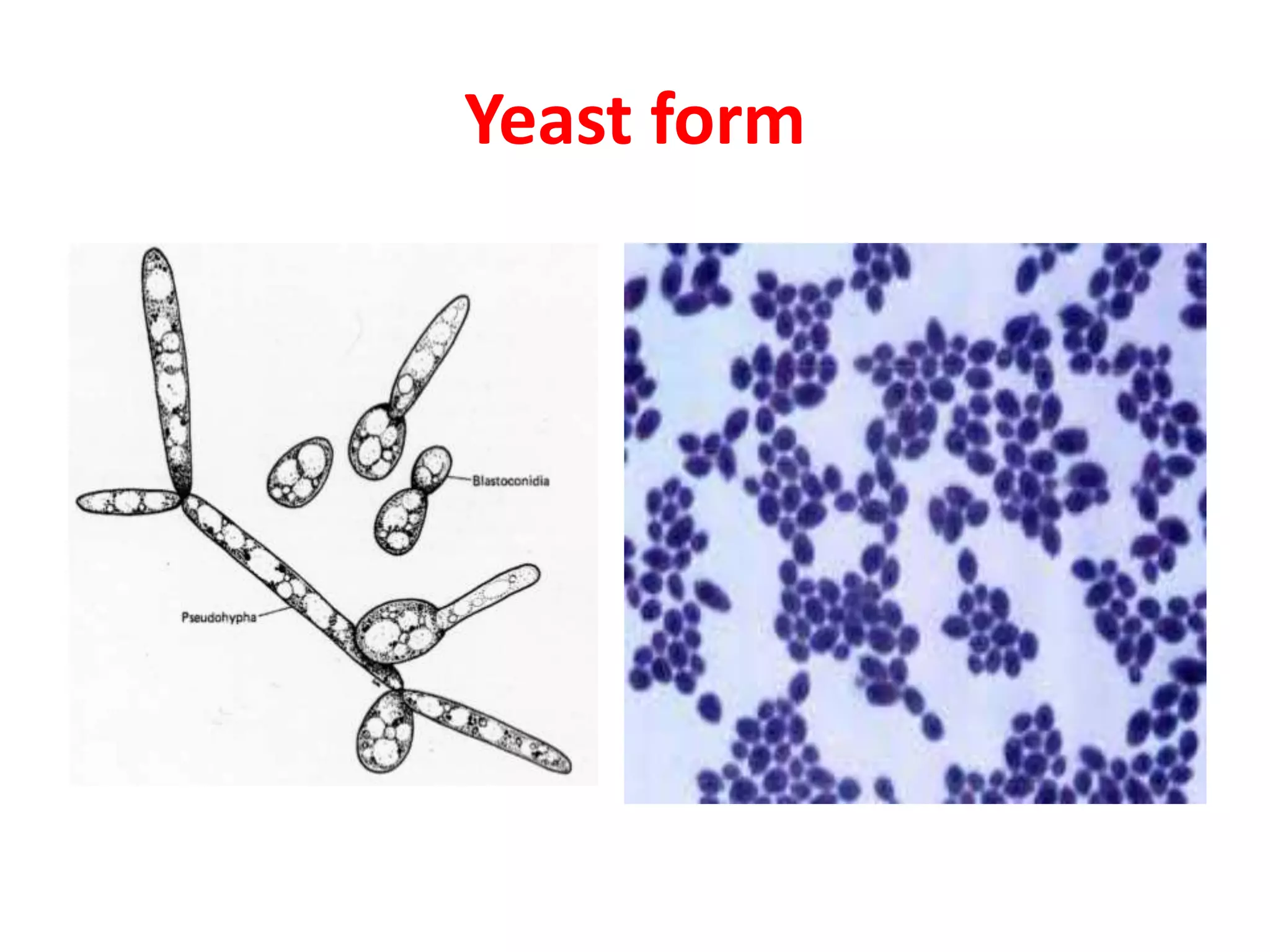 Morphology of fungi | PPTX