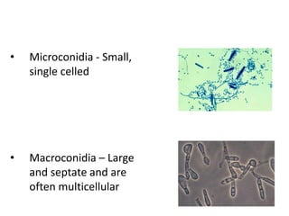 Morphology of fungi | PPTX