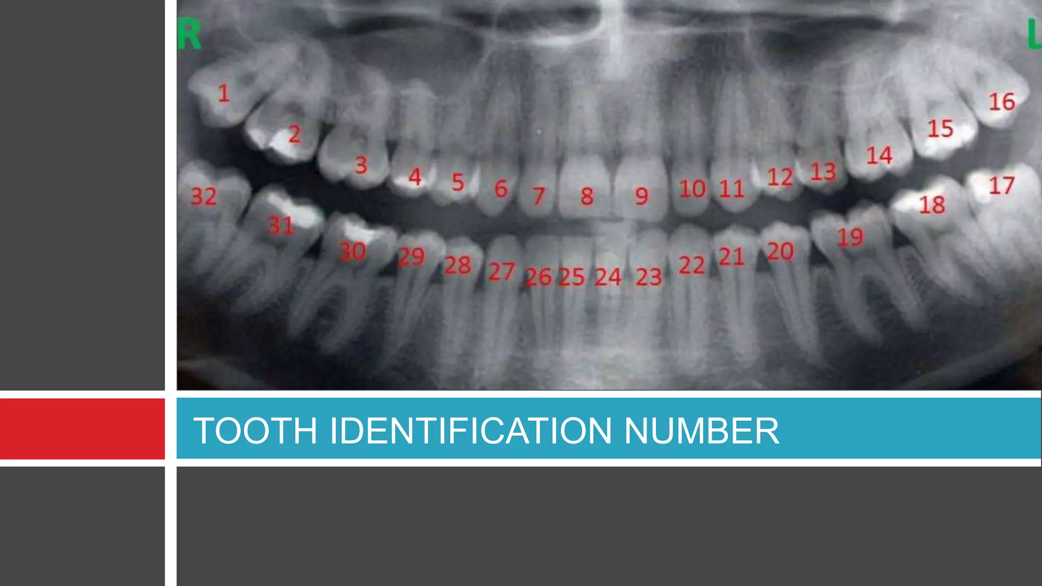 Morphology of human permanent dentition | PPTX