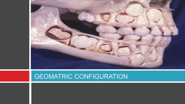 Morphology of human permanent dentition | PPTX