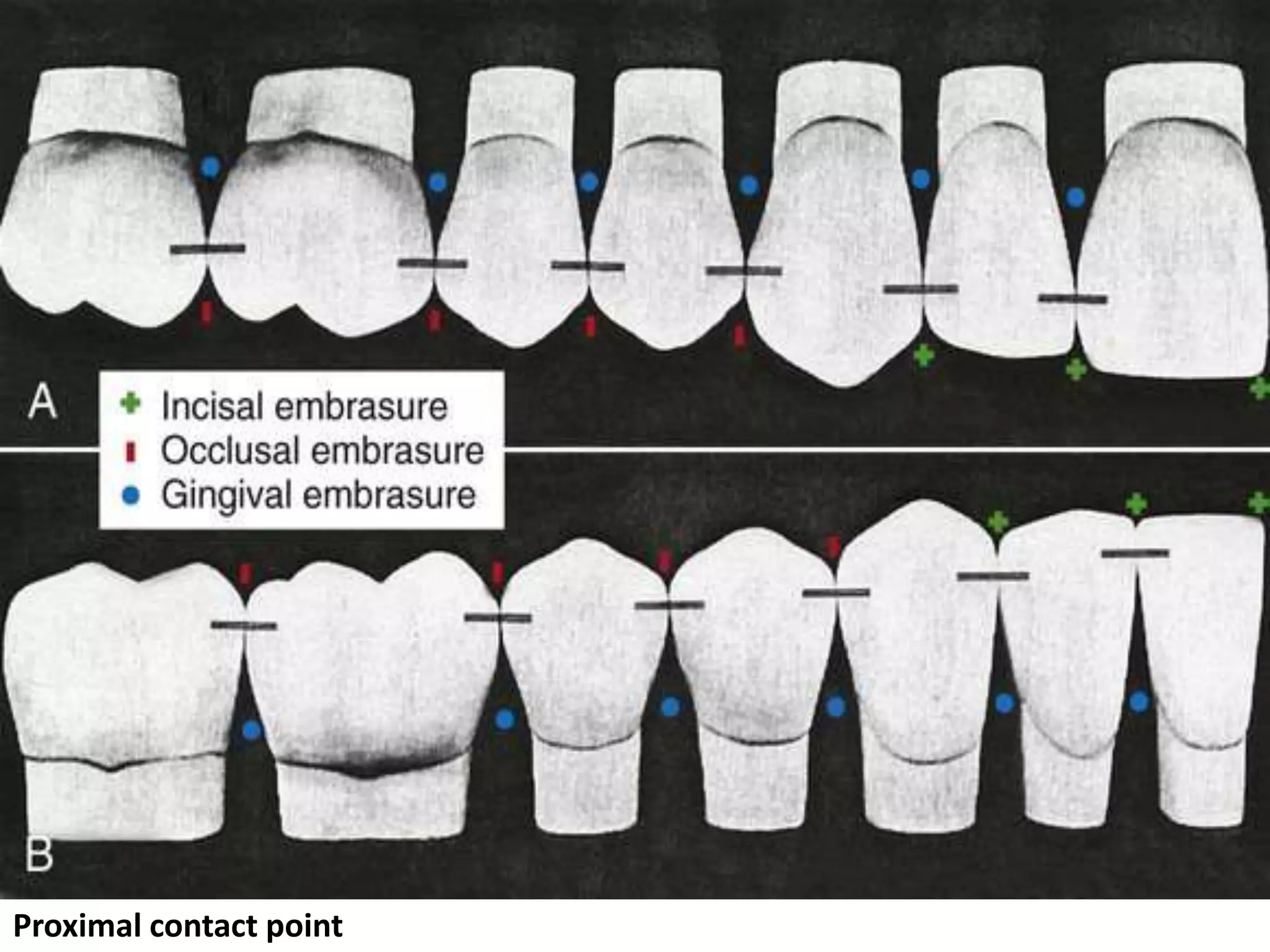morphology of permanent teeth.pptx