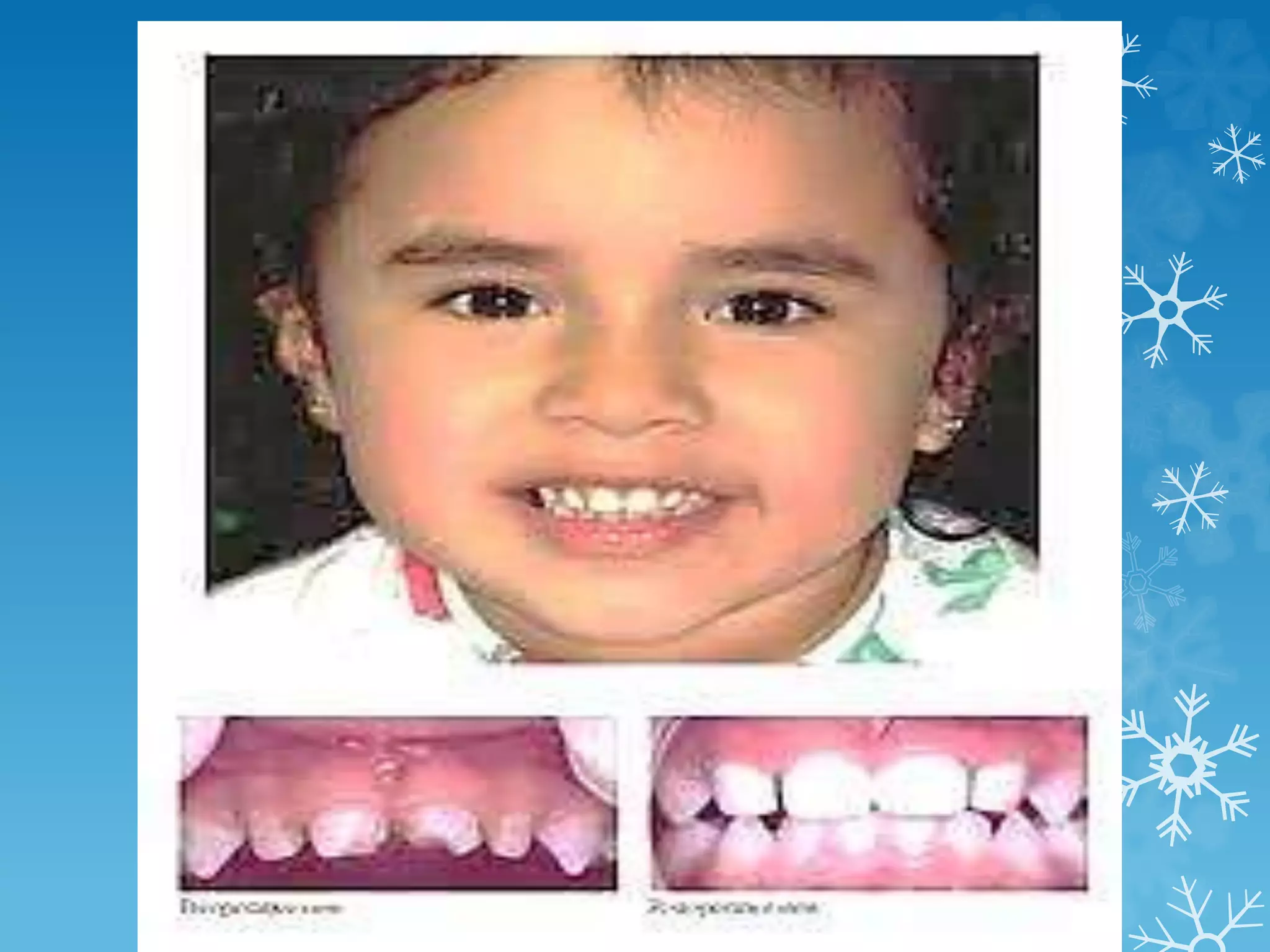 Morphology of primary teeth | PPTX