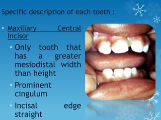 Morphology of primary teeth | PPTX