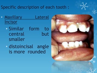 Morphology of primary teeth | PPTX