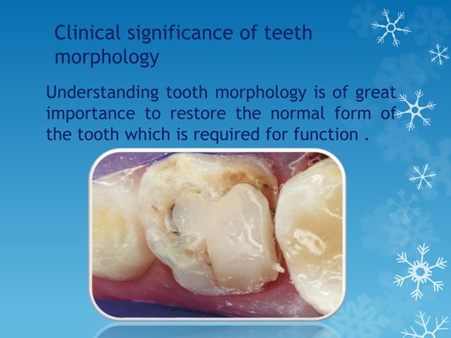 Morphology of primary teeth | PPTX