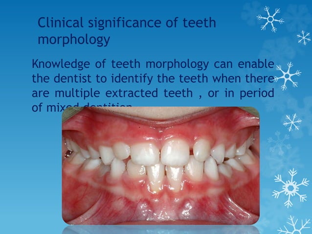 Morphology of primary teeth | PPTX