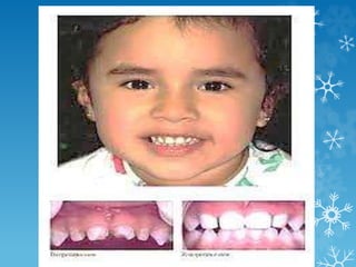Morphology of primary teeth | PPTX
