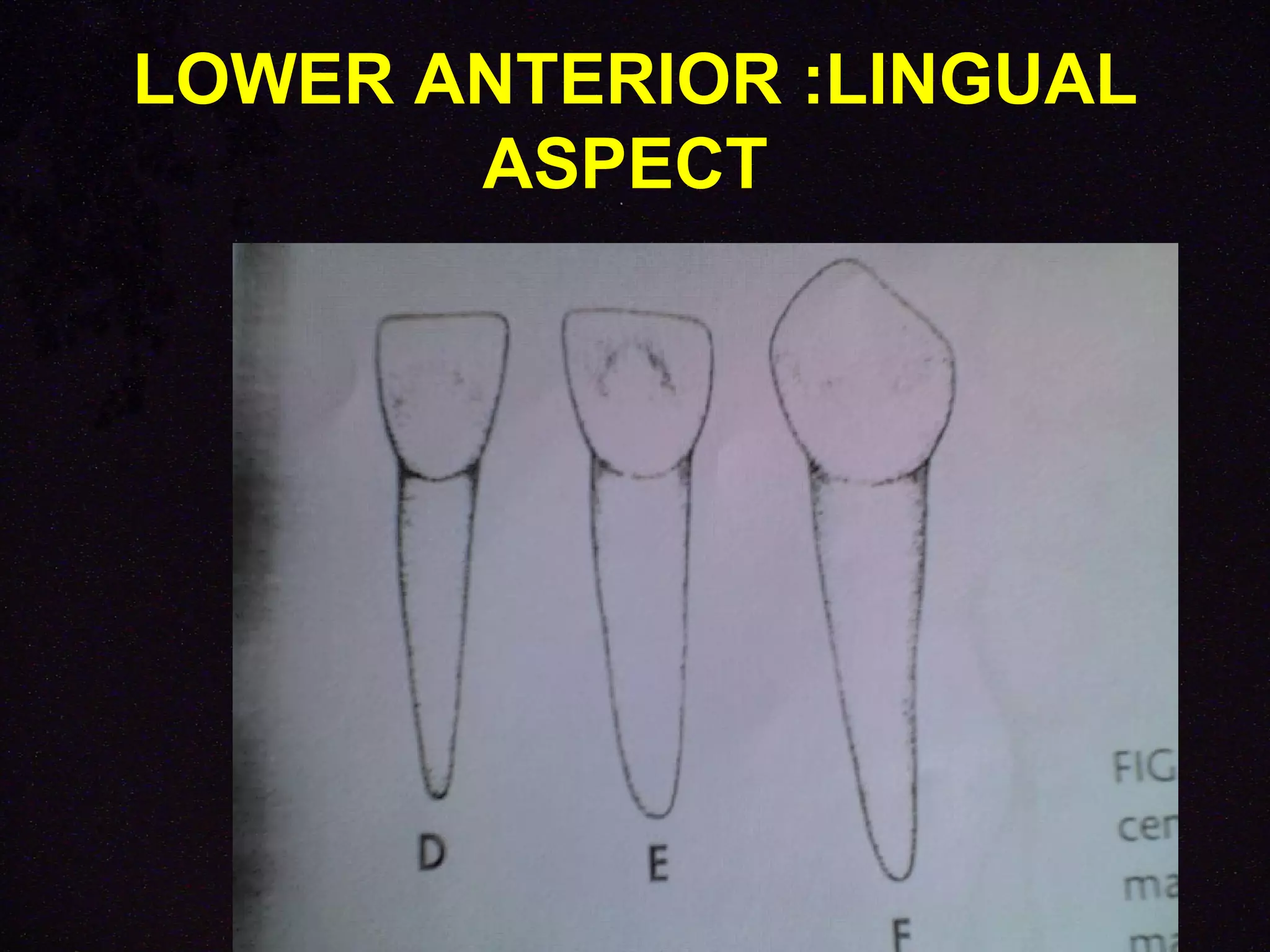 Morphology of primary teeth pedodontics | PPT