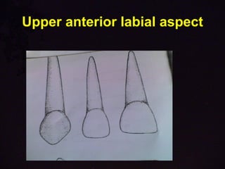 Morphology of primary teeth pedodontics | PPT