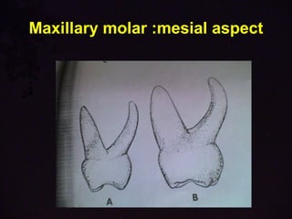 Morphology of primary teeth pedodontics | PPT