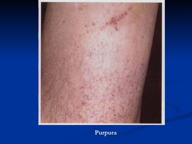 Morphology of skin lesions | PPT