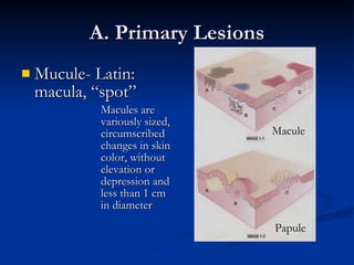 Morphology of skin lesions | PPT