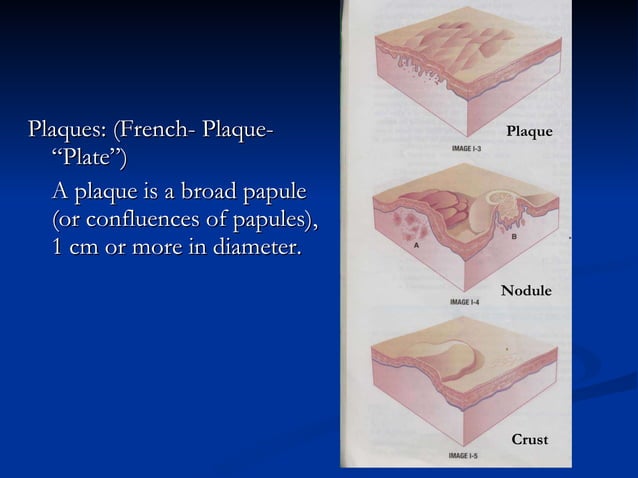 Morphology of skin lesions | PPT | Death, Injury, or Military Conflict ...