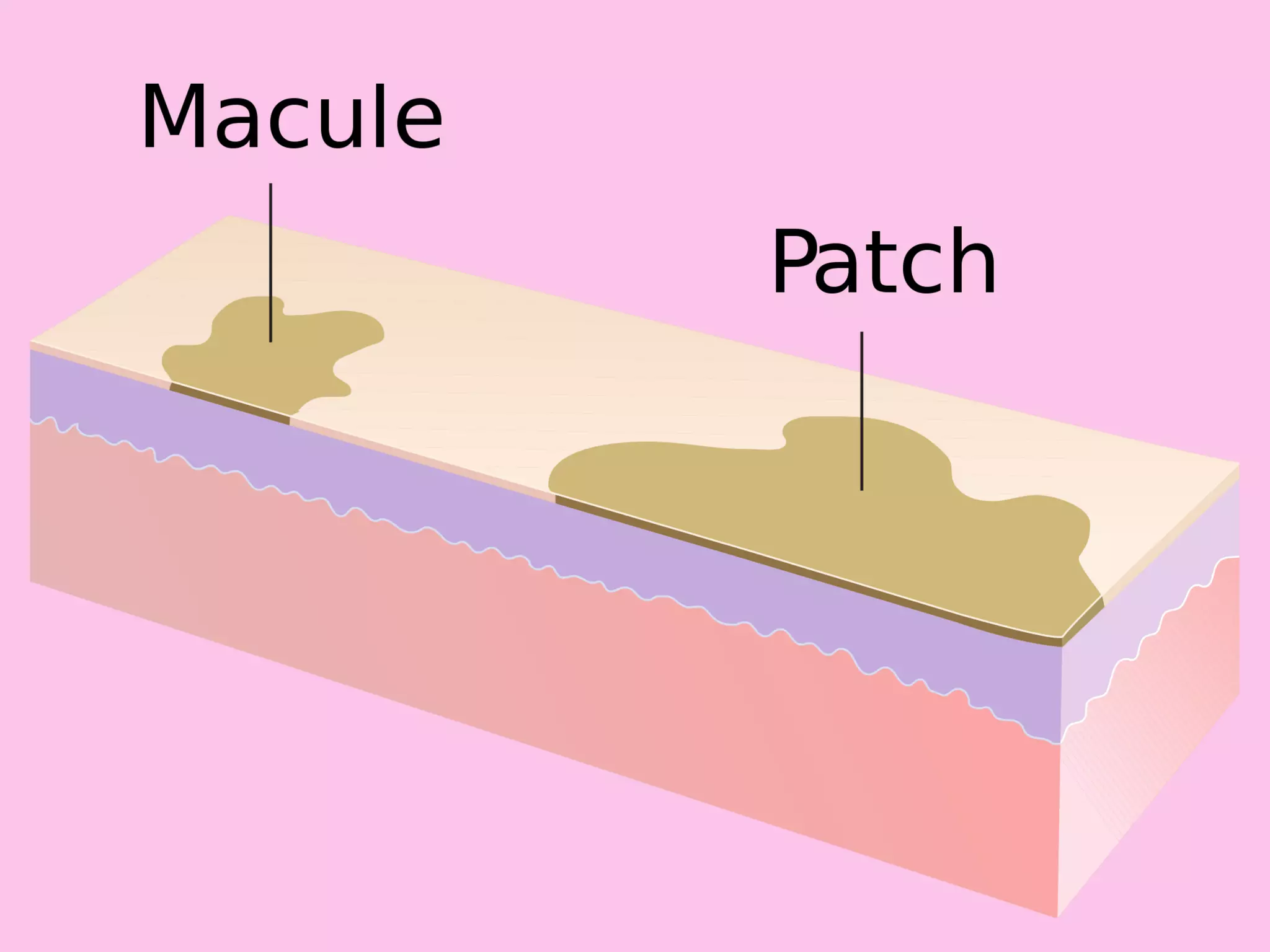 Morphology of Skin Lesions | PDF