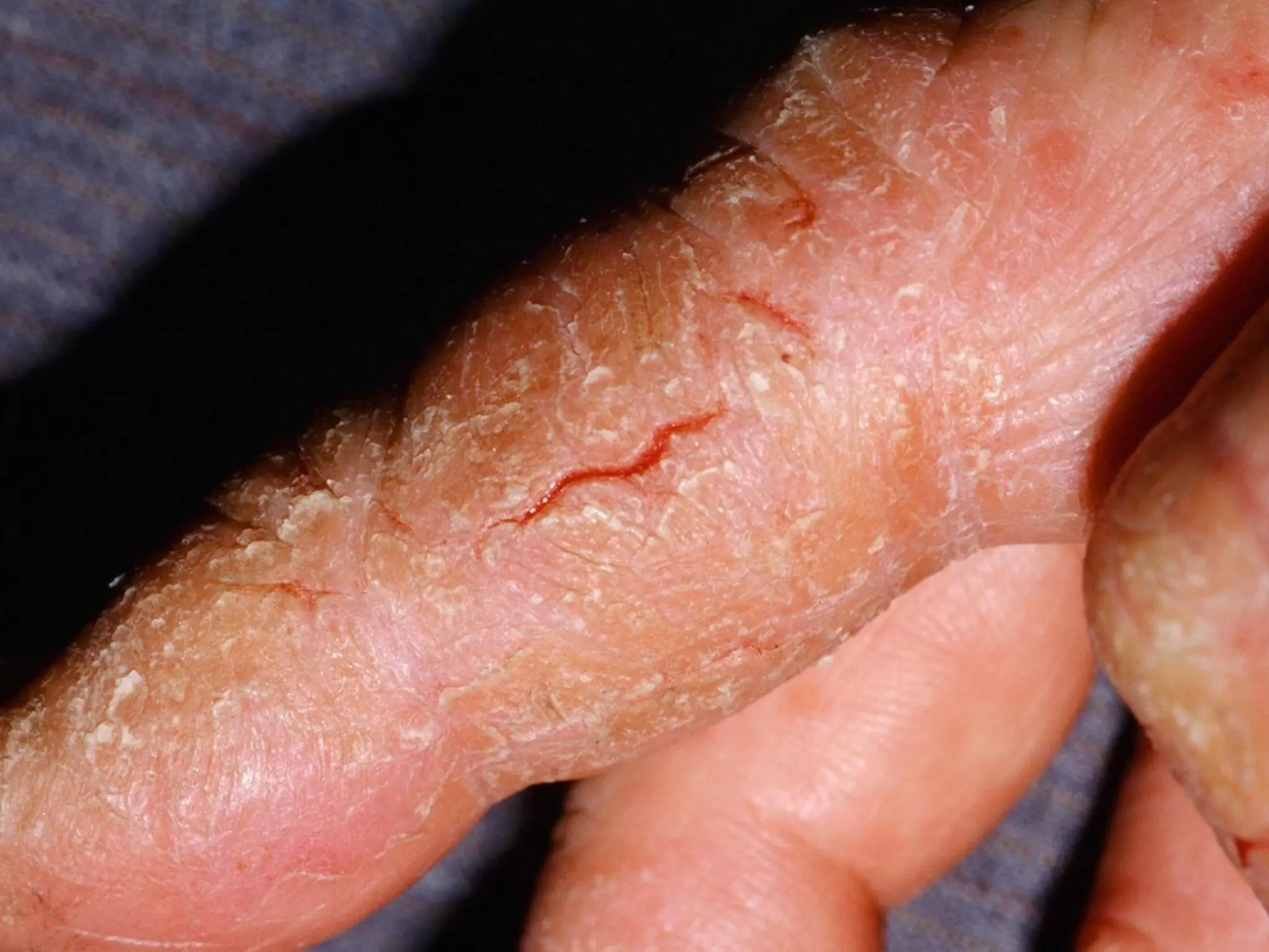 Morphology of Skin Lesions | PDF