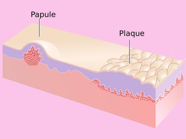 Morphology of Skin Lesions | PDF | Skin and Dermatology | Diseases and ...