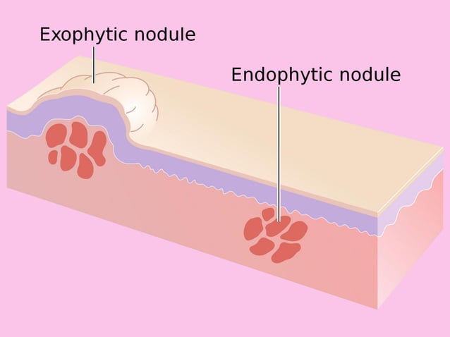 Morphology of Skin Lesions | PDF | Skin and Dermatology | Diseases and ...