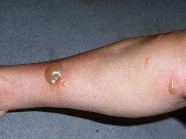 Morphology of Skin Lesions | PDF | Skin and Dermatology | Diseases and ...