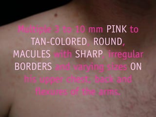 Morphology of Skin Lesions | PDF