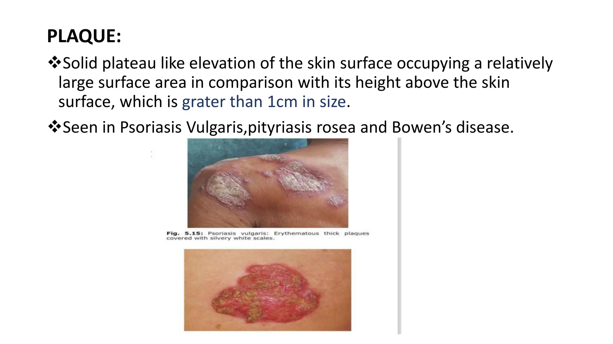 MORPHOLOGY OF SKIN LESIONS powerpoint dvl | PPT
