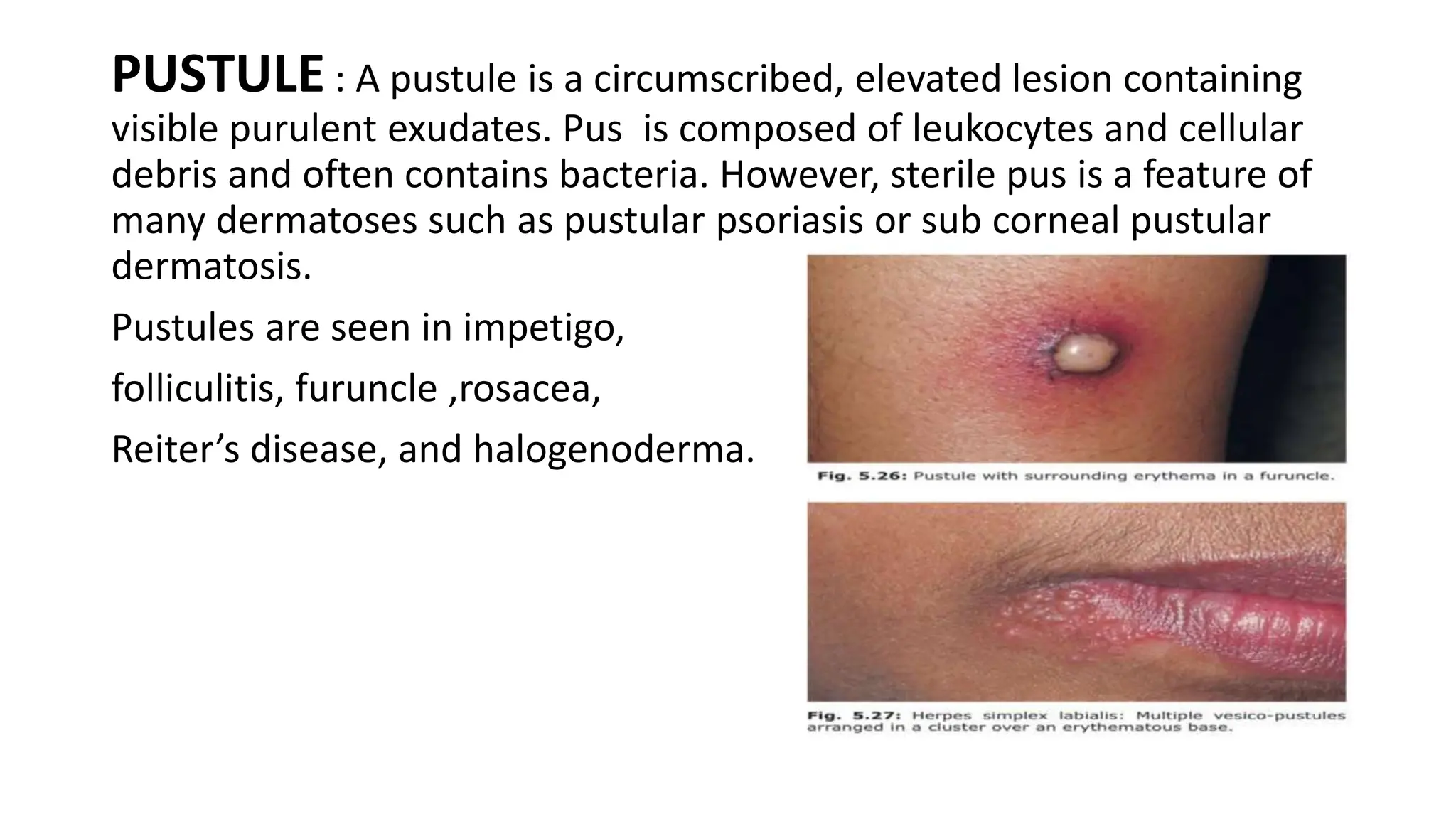 MORPHOLOGY OF SKIN LESIONS powerpoint dvl | PPT