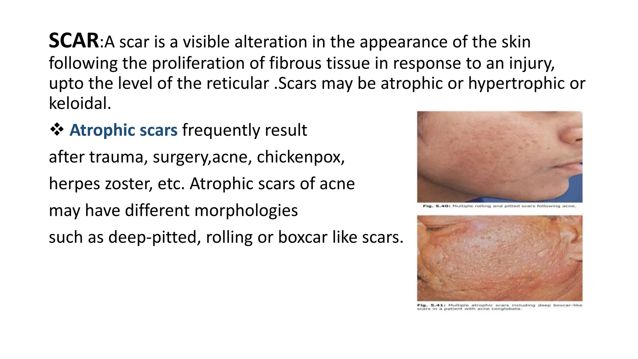MORPHOLOGY OF SKIN LESIONS powerpoint dvl | PPT
