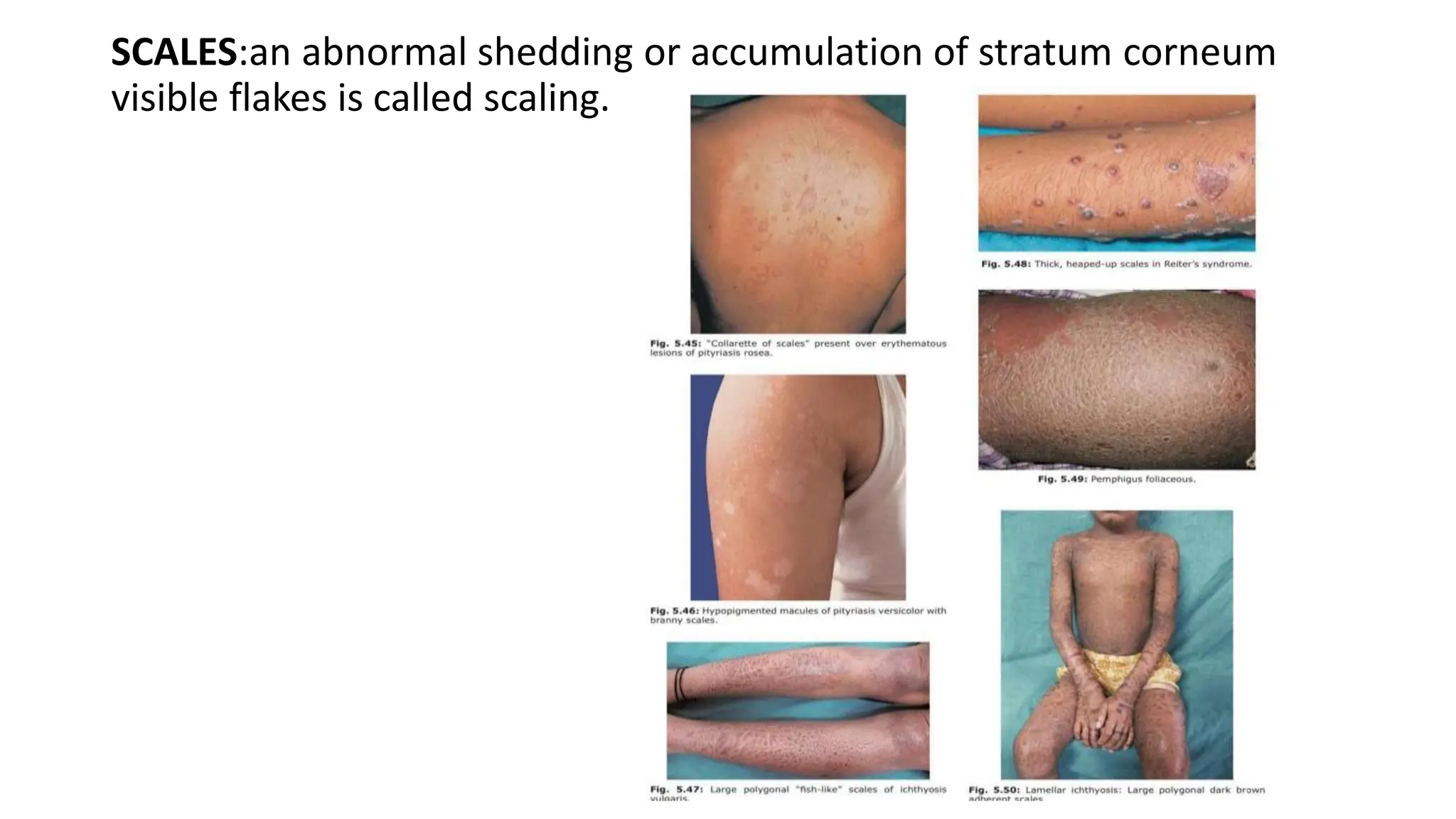 MORPHOLOGY OF SKIN LESIONS powerpoint dvl | PPT