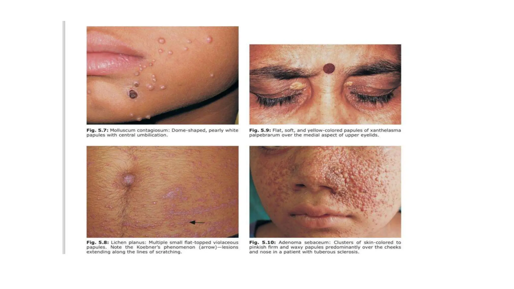 MORPHOLOGY OF SKIN LESIONS powerpoint dvl | PPT