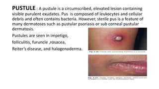 MORPHOLOGY OF SKIN LESIONS powerpoint dvl | PPT