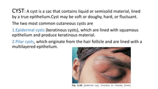 MORPHOLOGY OF SKIN LESIONS powerpoint dvl | PPT