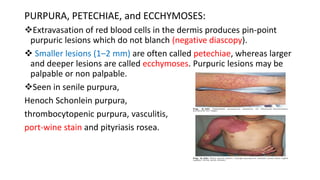 MORPHOLOGY OF SKIN LESIONS powerpoint dvl | PPT