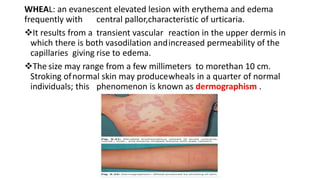 MORPHOLOGY OF SKIN LESIONS powerpoint dvl | PPT